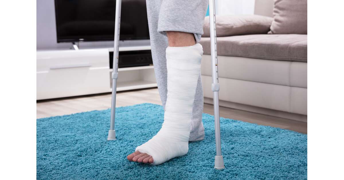 Noga w gipsie - jak o nią prawidłowo zadbać?